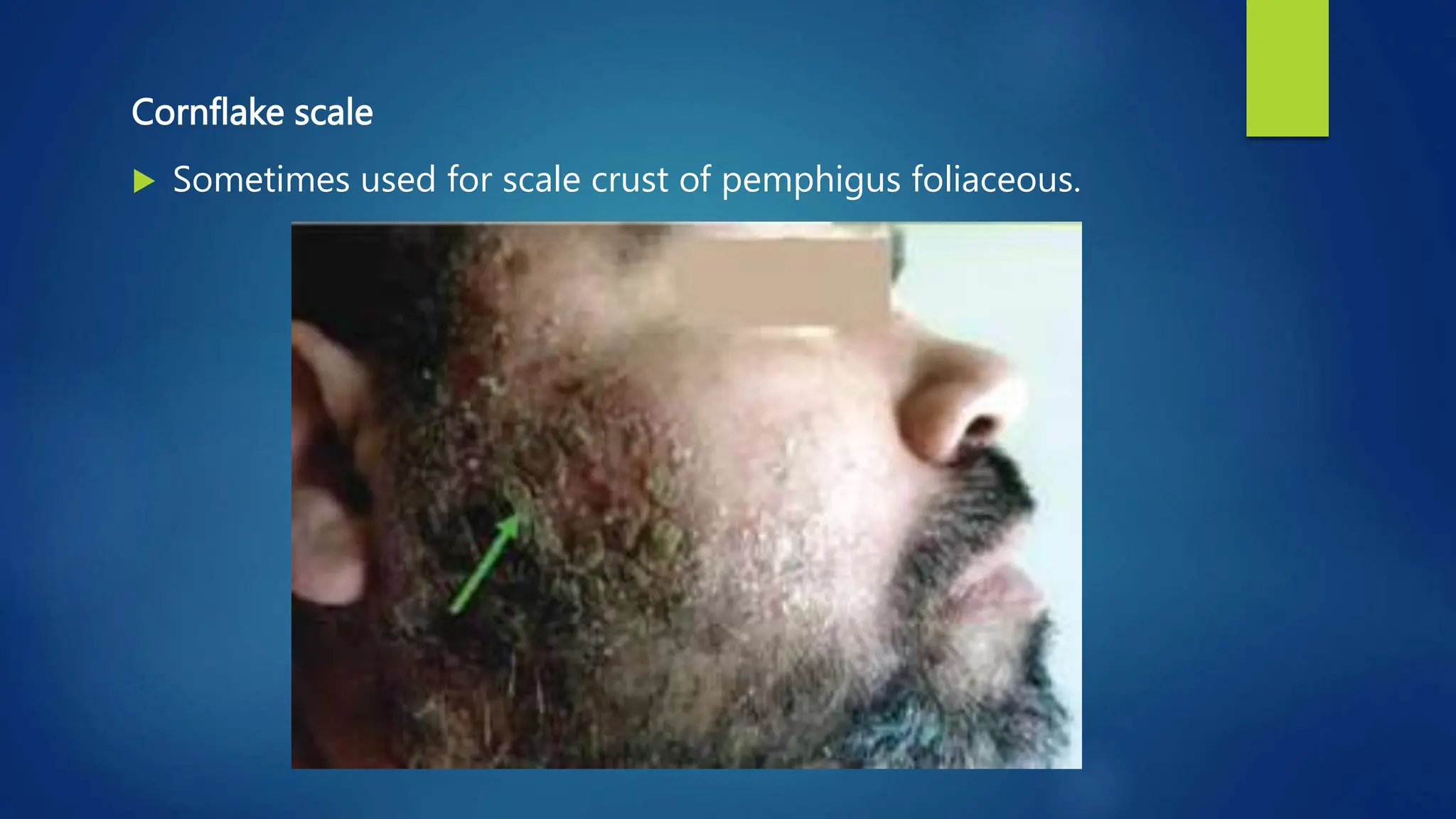 Scaly signs in dermatology. Article discussion | PPTX