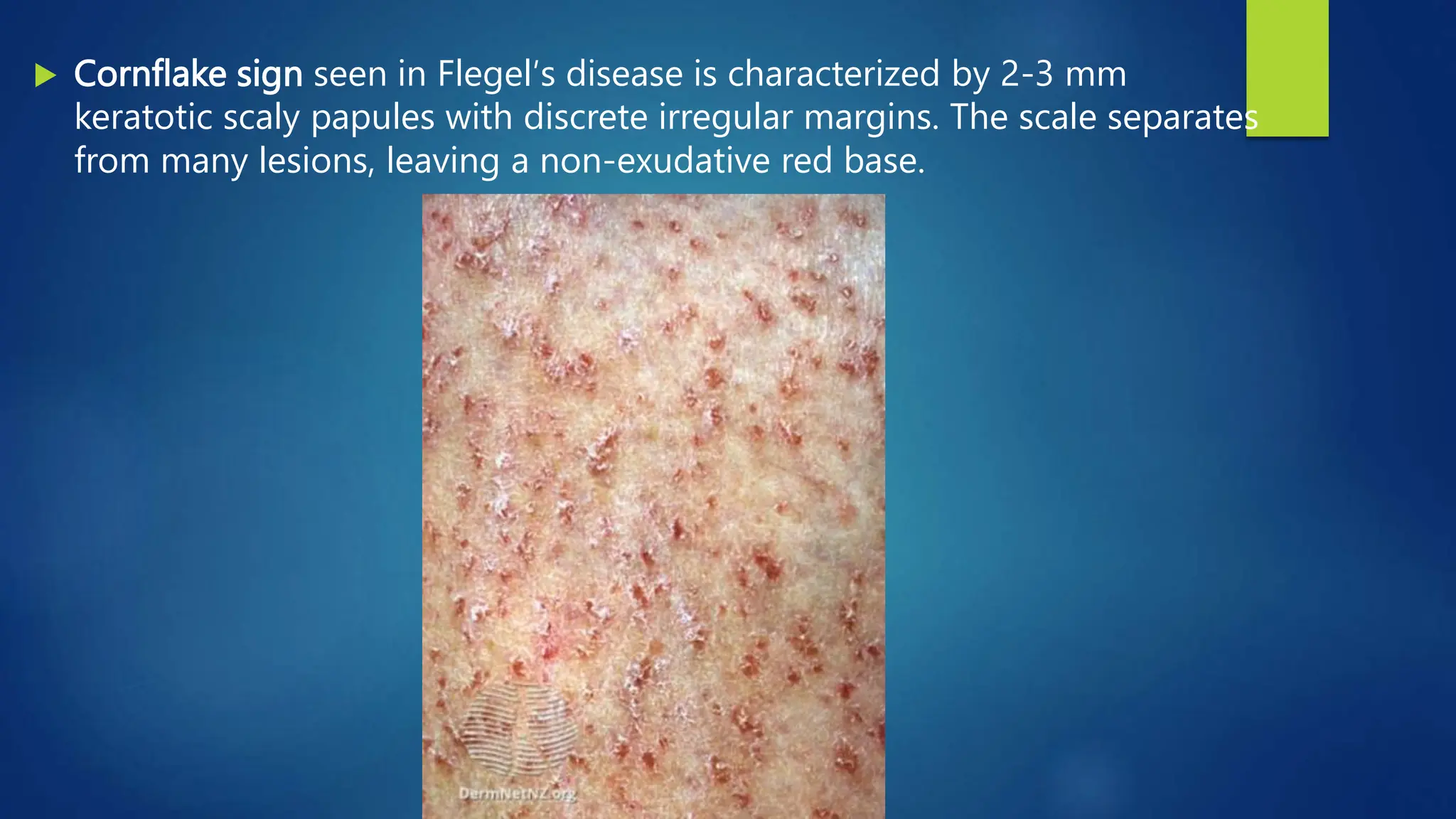 Scaly signs in dermatology. Article discussion | PPTX