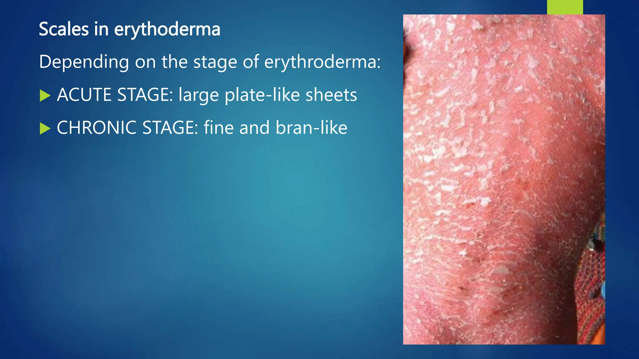Scaly signs in dermatology. Article discussion | PPTX