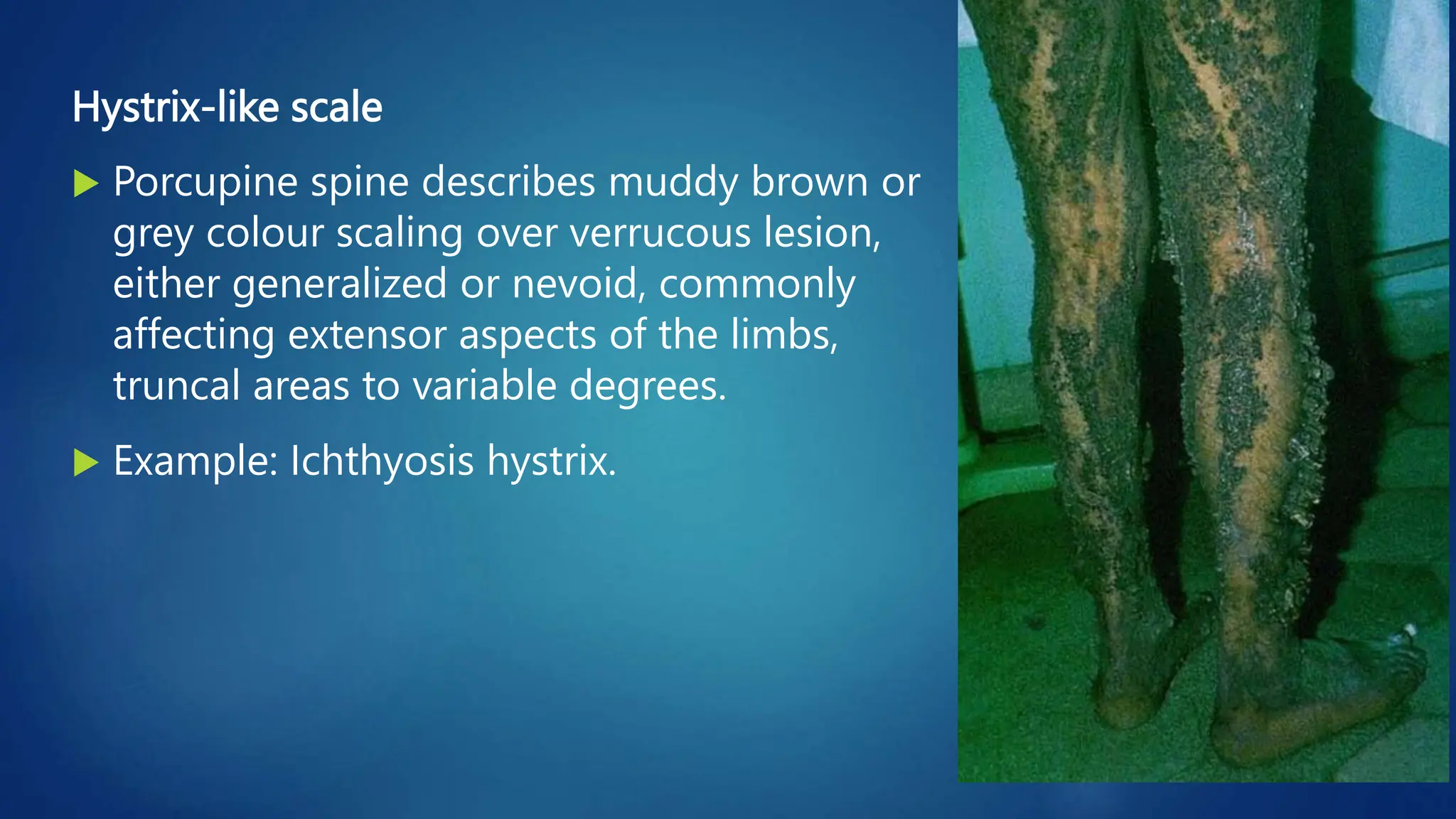 Scaly signs in dermatology. Article discussion | PPTX