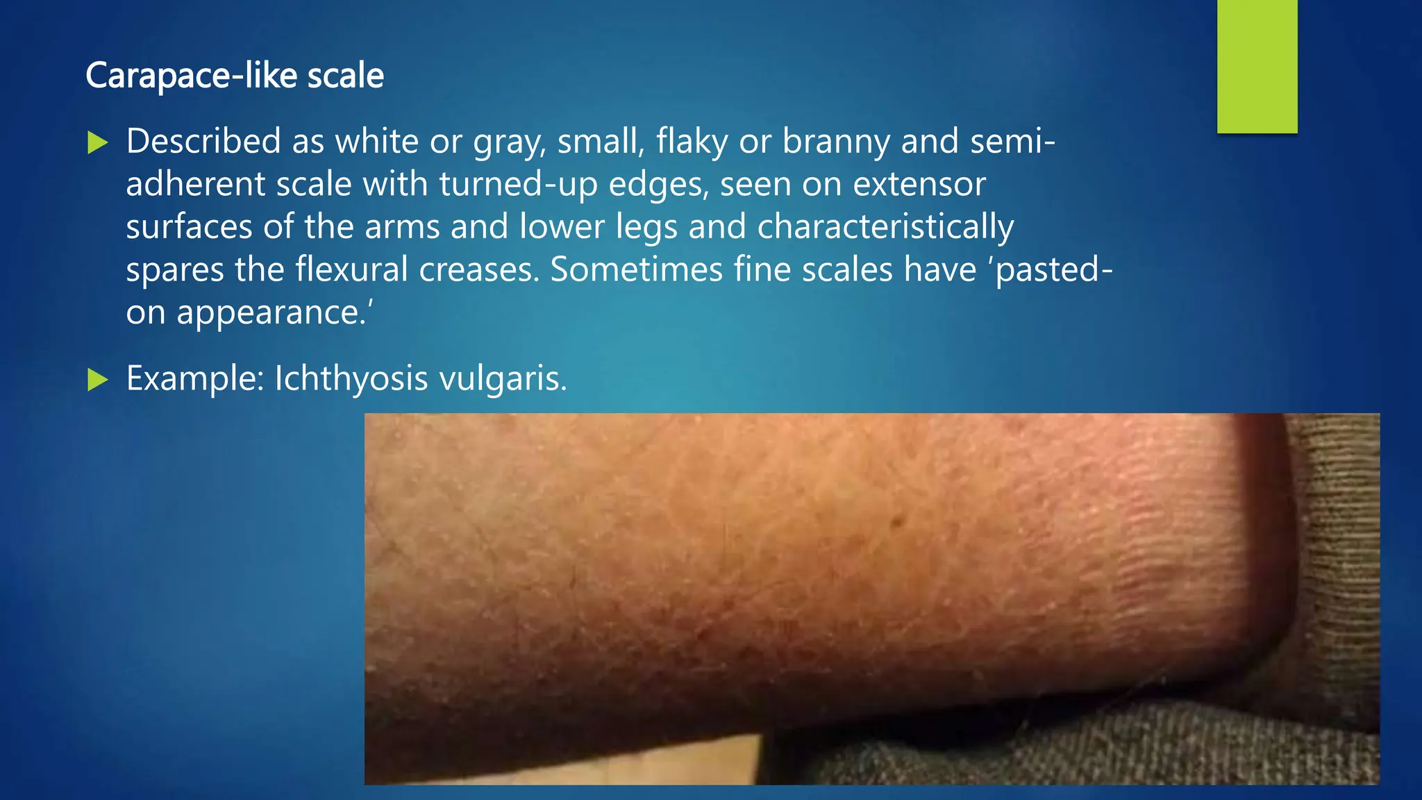 Scaly signs in dermatology. Article discussion | PPTX
