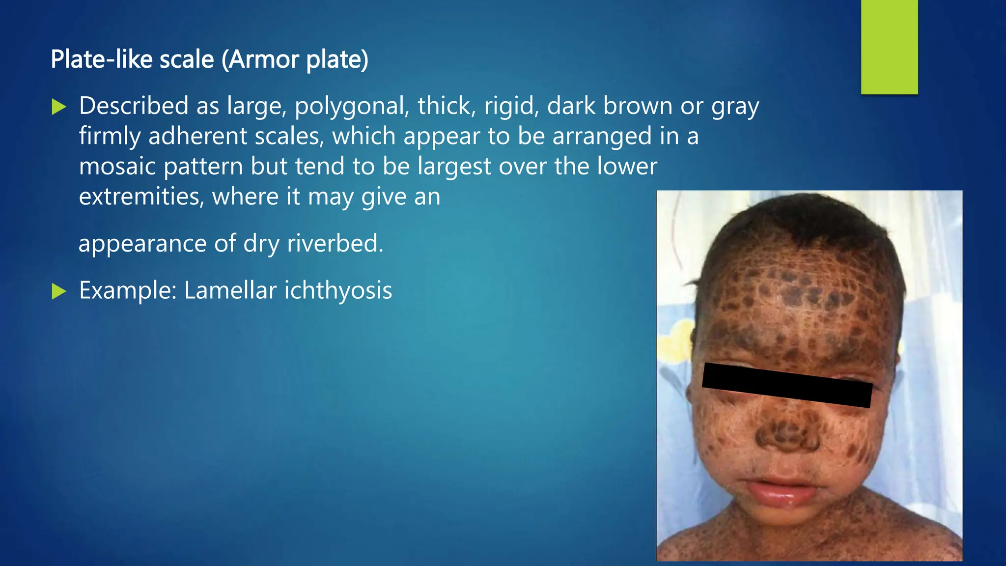 Scaly signs in dermatology. Article discussion | PPTX