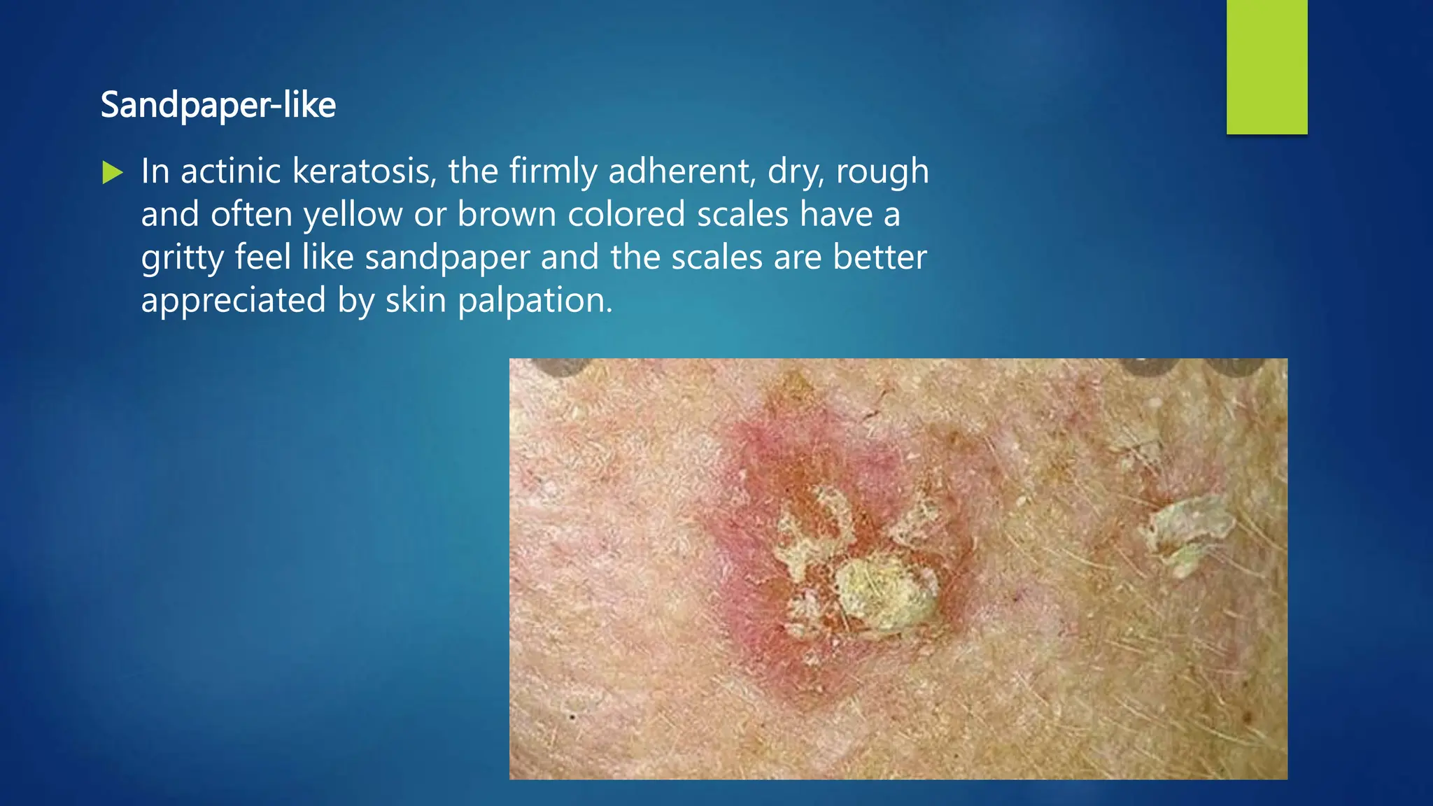Scaly signs in dermatology. Article discussion | PPTX