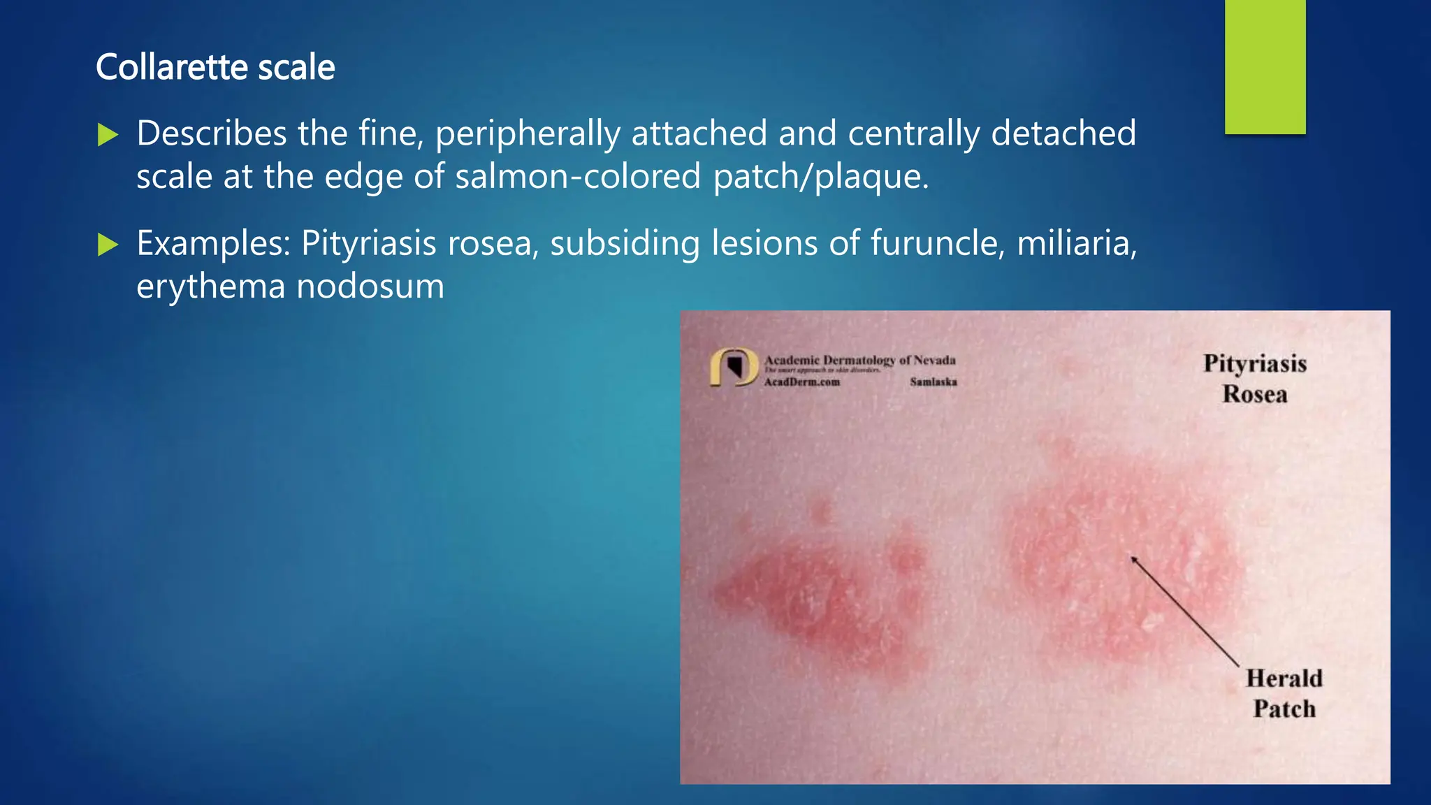 Scaly signs in dermatology. Article discussion | PPTX