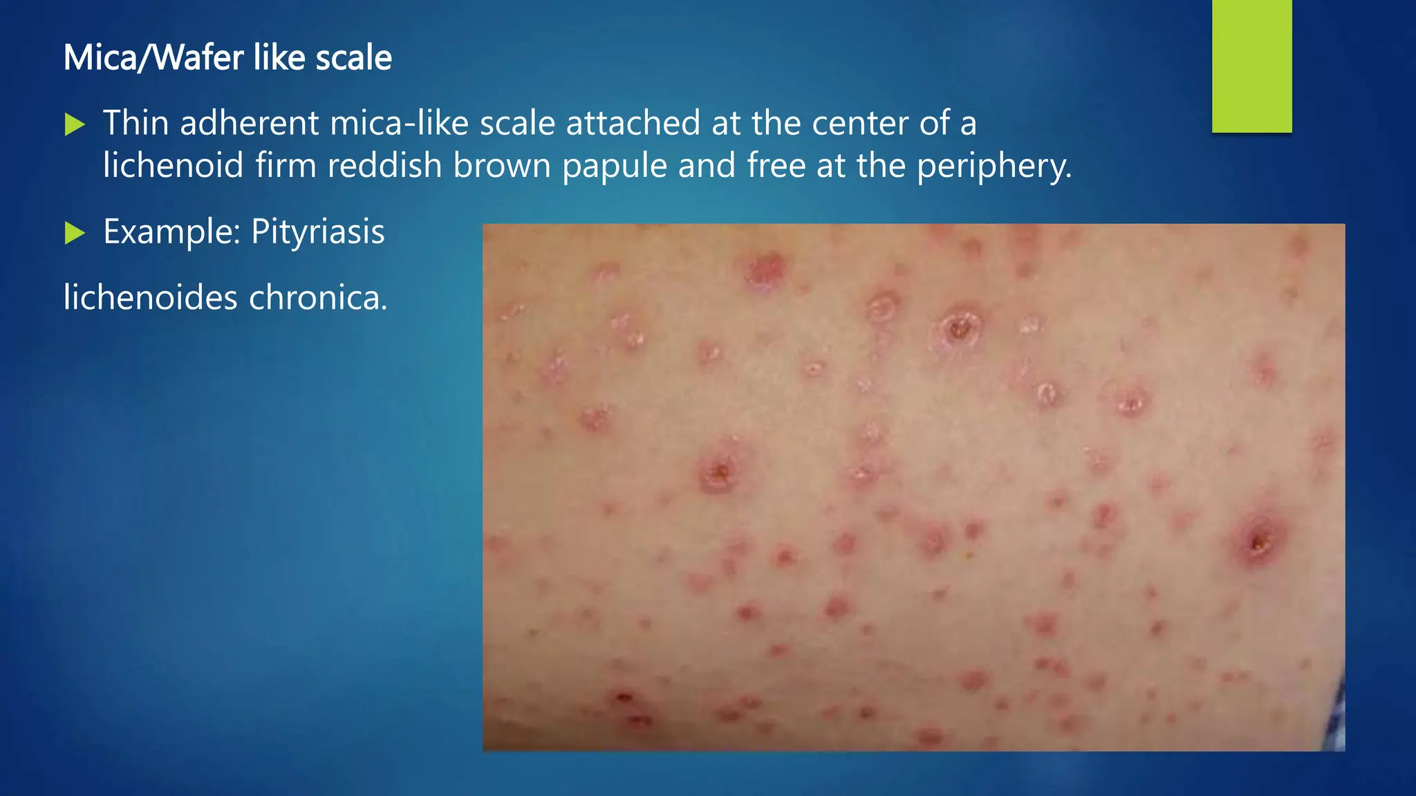 Scaly signs in dermatology. Article discussion | PPTX
