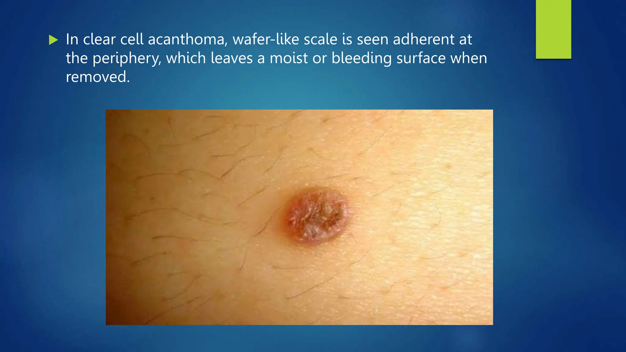 Scaly signs in dermatology. Article discussion | PPTX