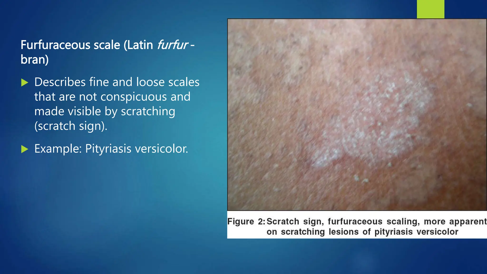 Scaly signs in dermatology. Article discussion | PPTX