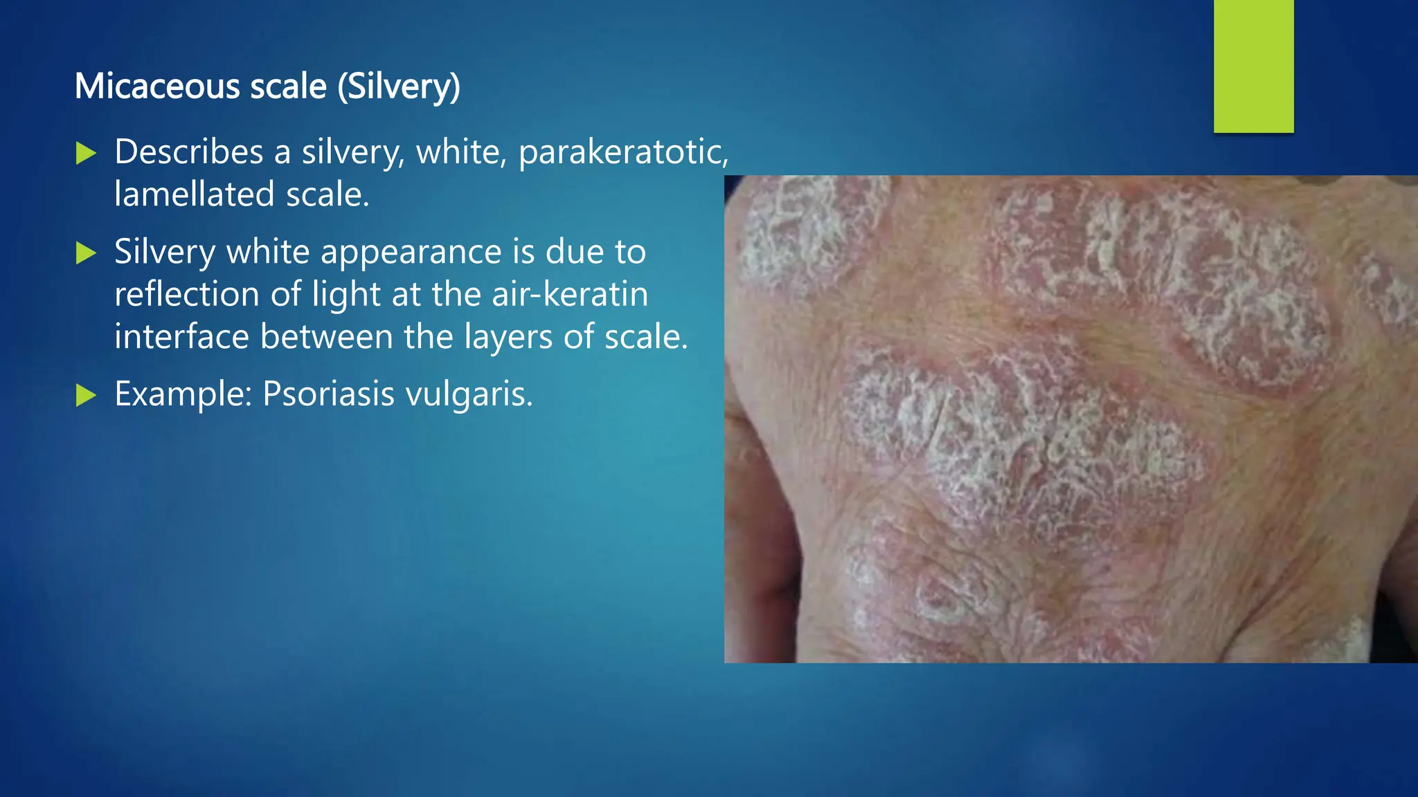 Scaly signs in dermatology. Article discussion | PPTX