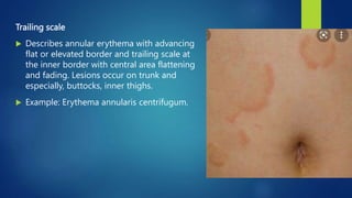 Scaly signs in dermatology. Article discussion | PPTX