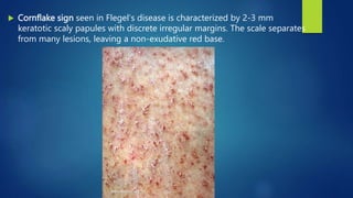 Scaly signs in dermatology. Article discussion | PPTX