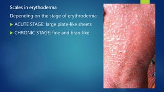 Scaly signs in dermatology. Article discussion | PPTX