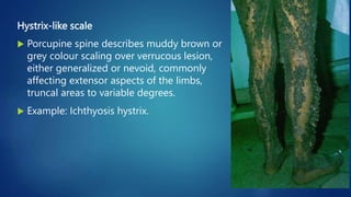 Scaly signs in dermatology. Article discussion | PPTX