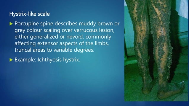 Scaly signs in dermatology. Article discussion | PPTX