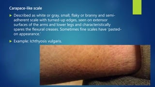 Scaly signs in dermatology. Article discussion | PPTX