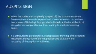 Scaly signs in dermatology. Article discussion | PPTX