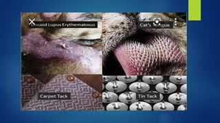 Scaly signs in dermatology. Article discussion | PPTX