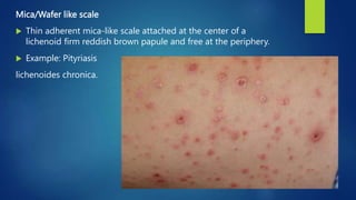 Scaly signs in dermatology. Article discussion | PPTX
