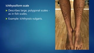 Scaly signs in dermatology. Article discussion | PPTX