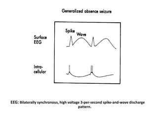 Types of Seizure | PPTX