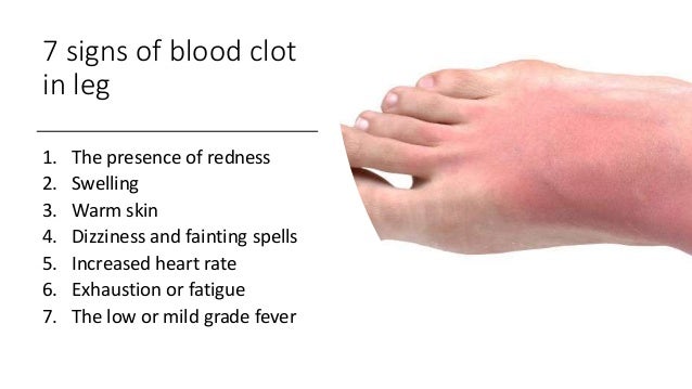 Signs Of Blood Clot In Leg