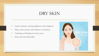 types of skin.pdf....................... | PDF