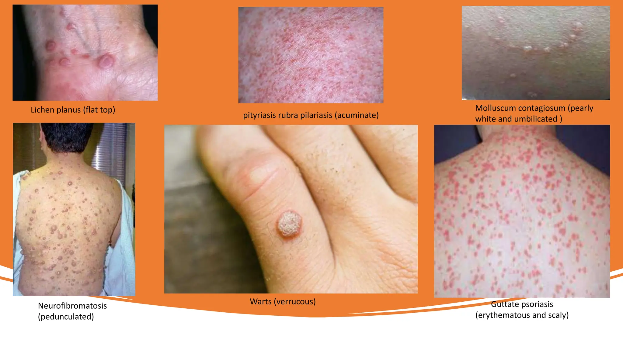 Clinical Classification of Skin Lesions: A Morphological Approach in ...