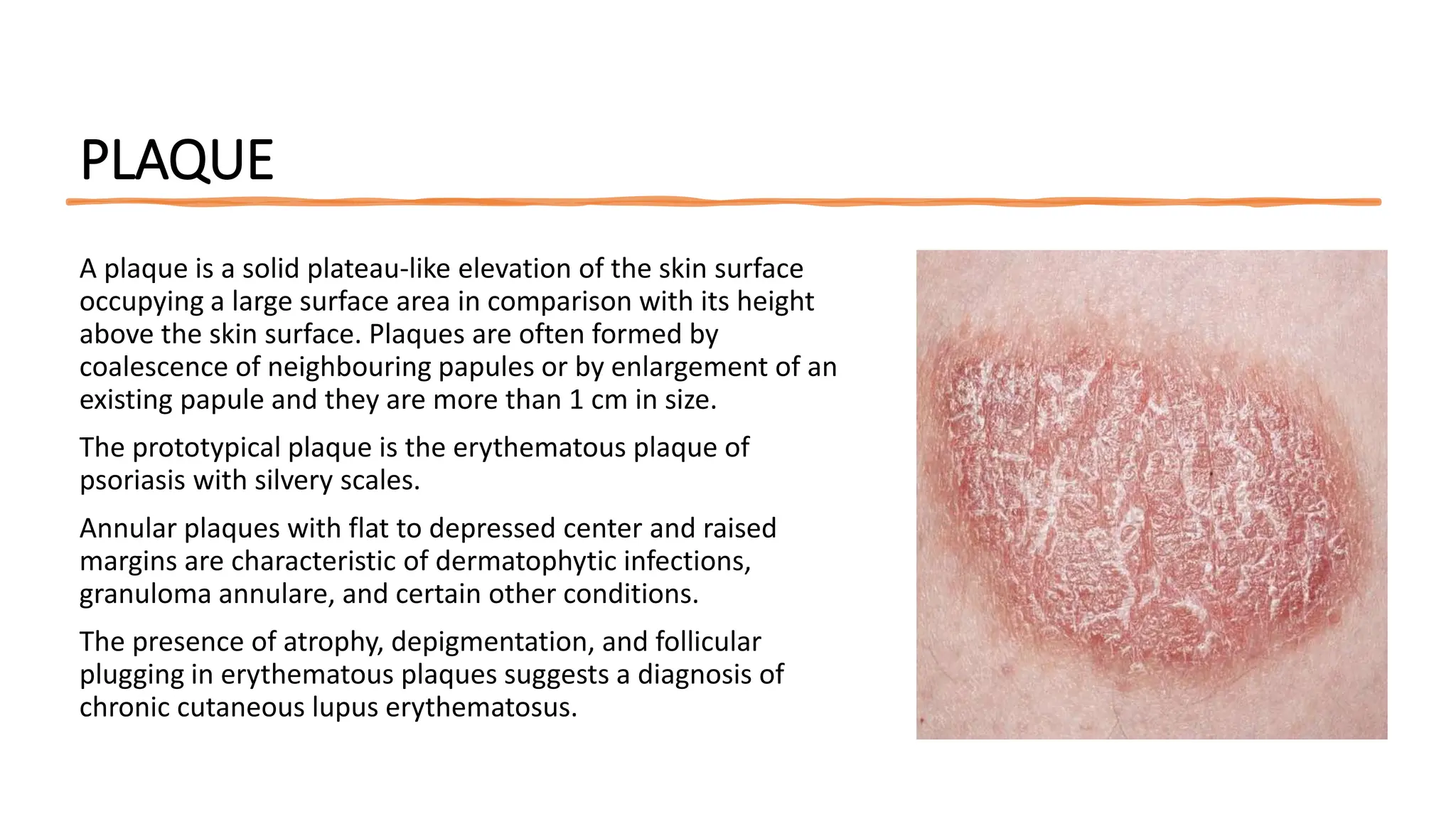 Clinical Classification of Skin Lesions: A Morphological Approach in ...