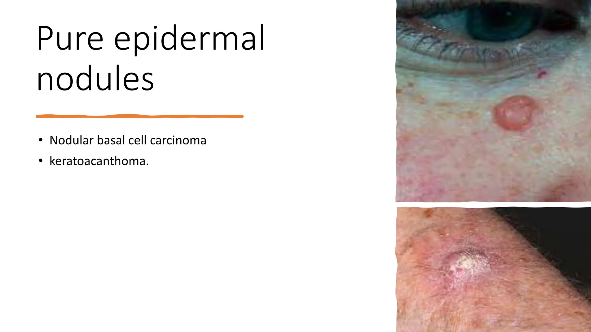 Clinical Classification of Skin Lesions: A Morphological Approach in ...