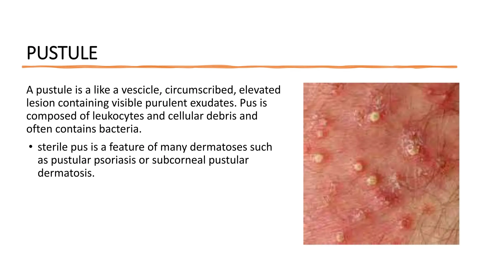 Clinical Classification of Skin Lesions: A Morphological Approach in ...