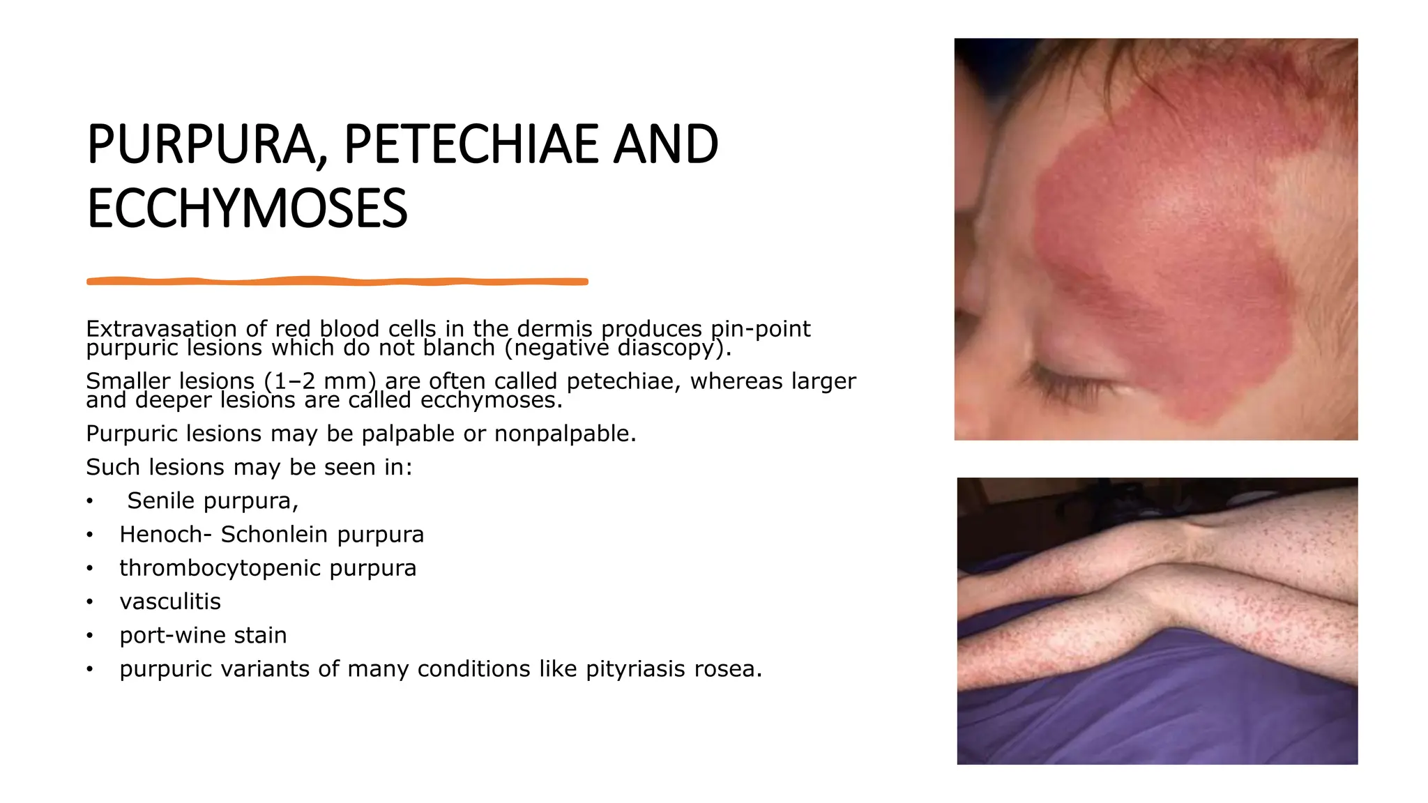 Clinical Classification of Skin Lesions: A Morphological Approach in ...