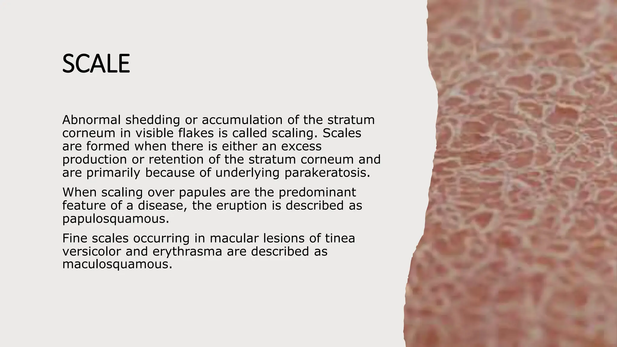 Clinical Classification of Skin Lesions: A Morphological Approach in ...