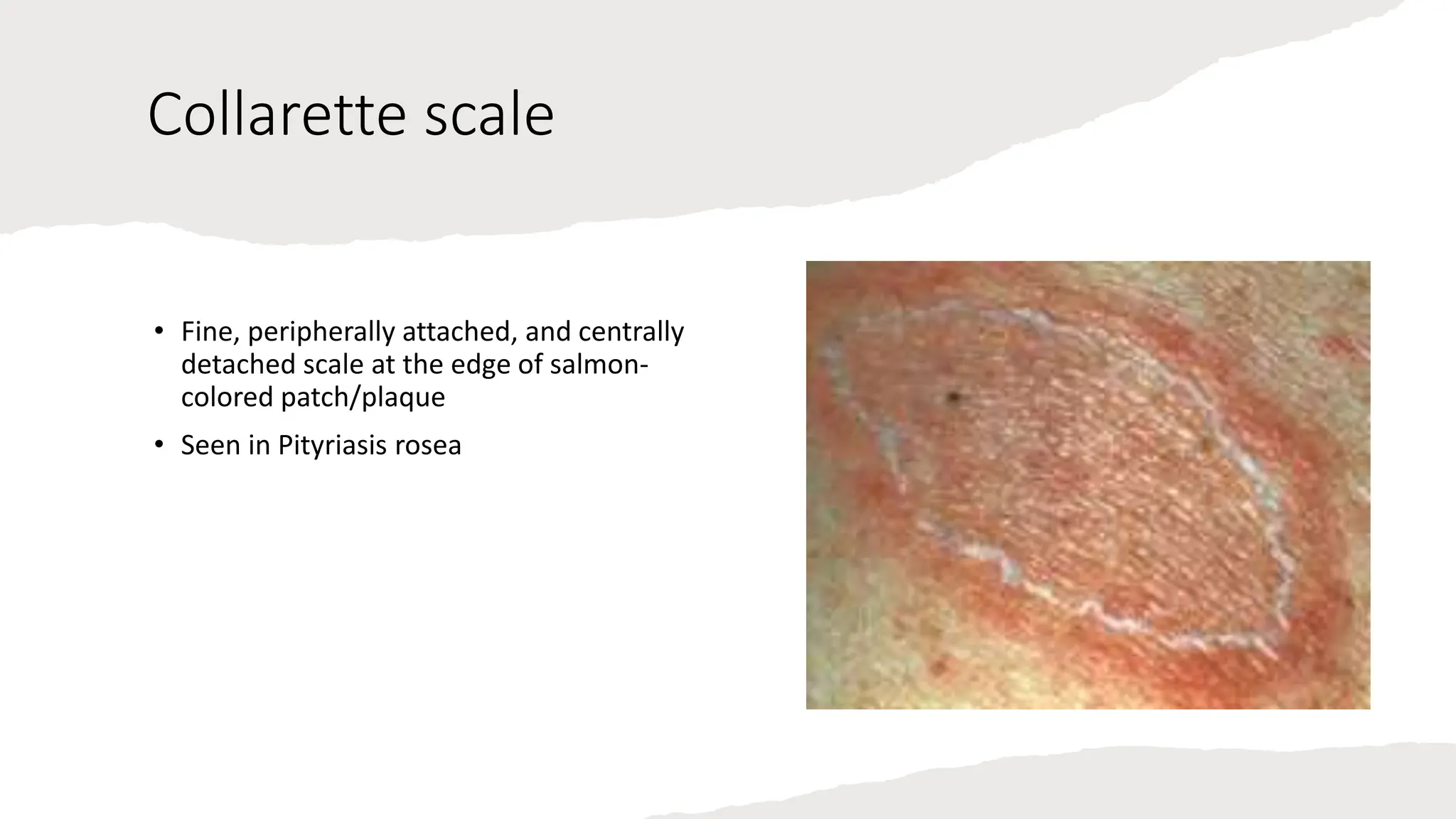 Clinical Classification of Skin Lesions: A Morphological Approach in ...