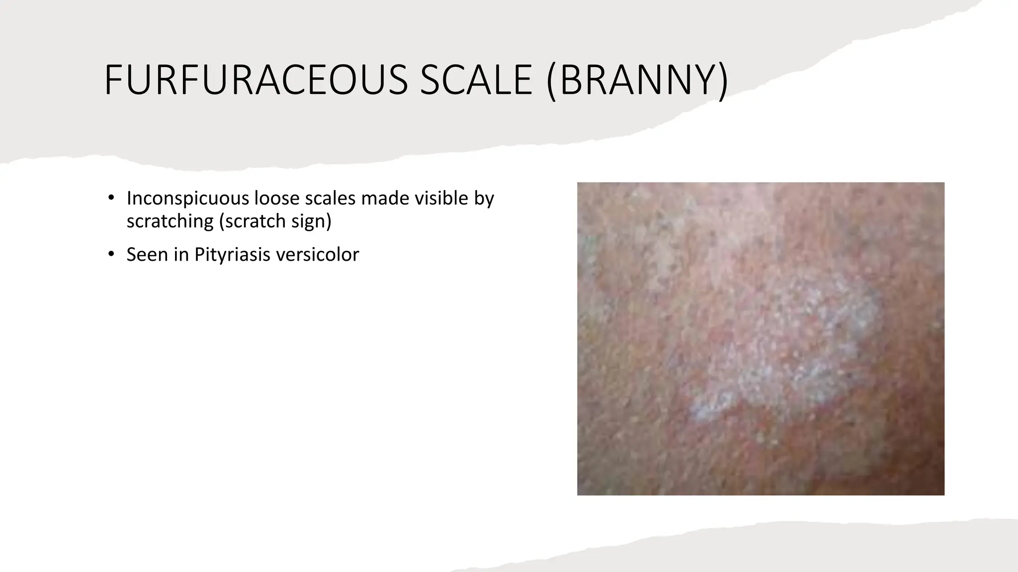Clinical Classification of Skin Lesions: A Morphological Approach in ...