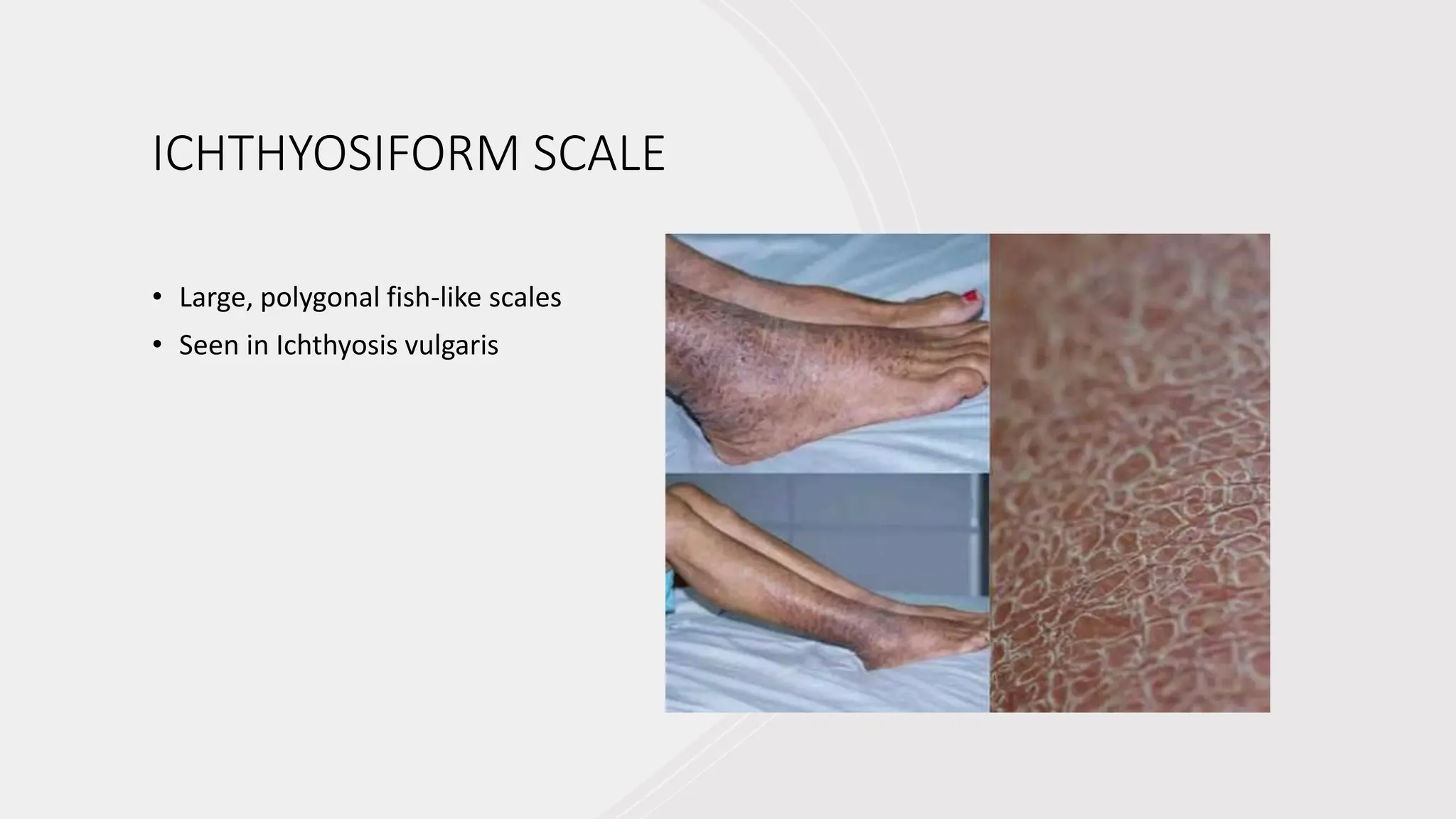 Clinical Classification of Skin Lesions: A Morphological Approach in ...