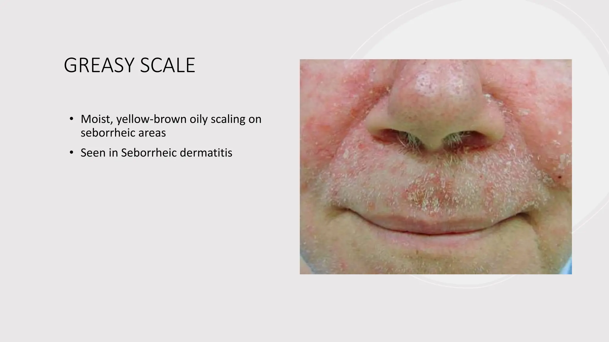 Clinical Classification of Skin Lesions: A Morphological Approach in ...