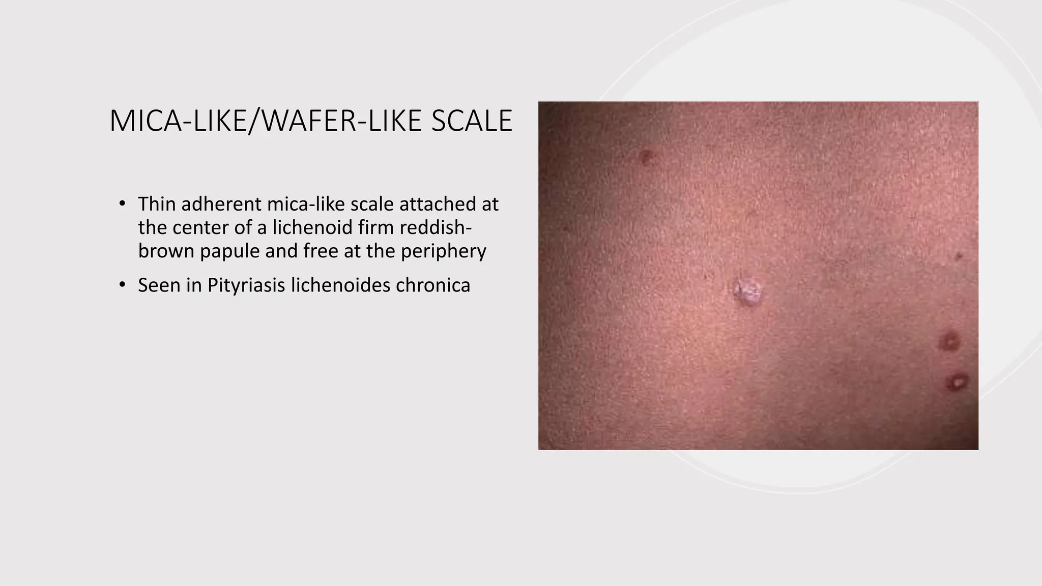Clinical Classification of Skin Lesions: A Morphological Approach in ...