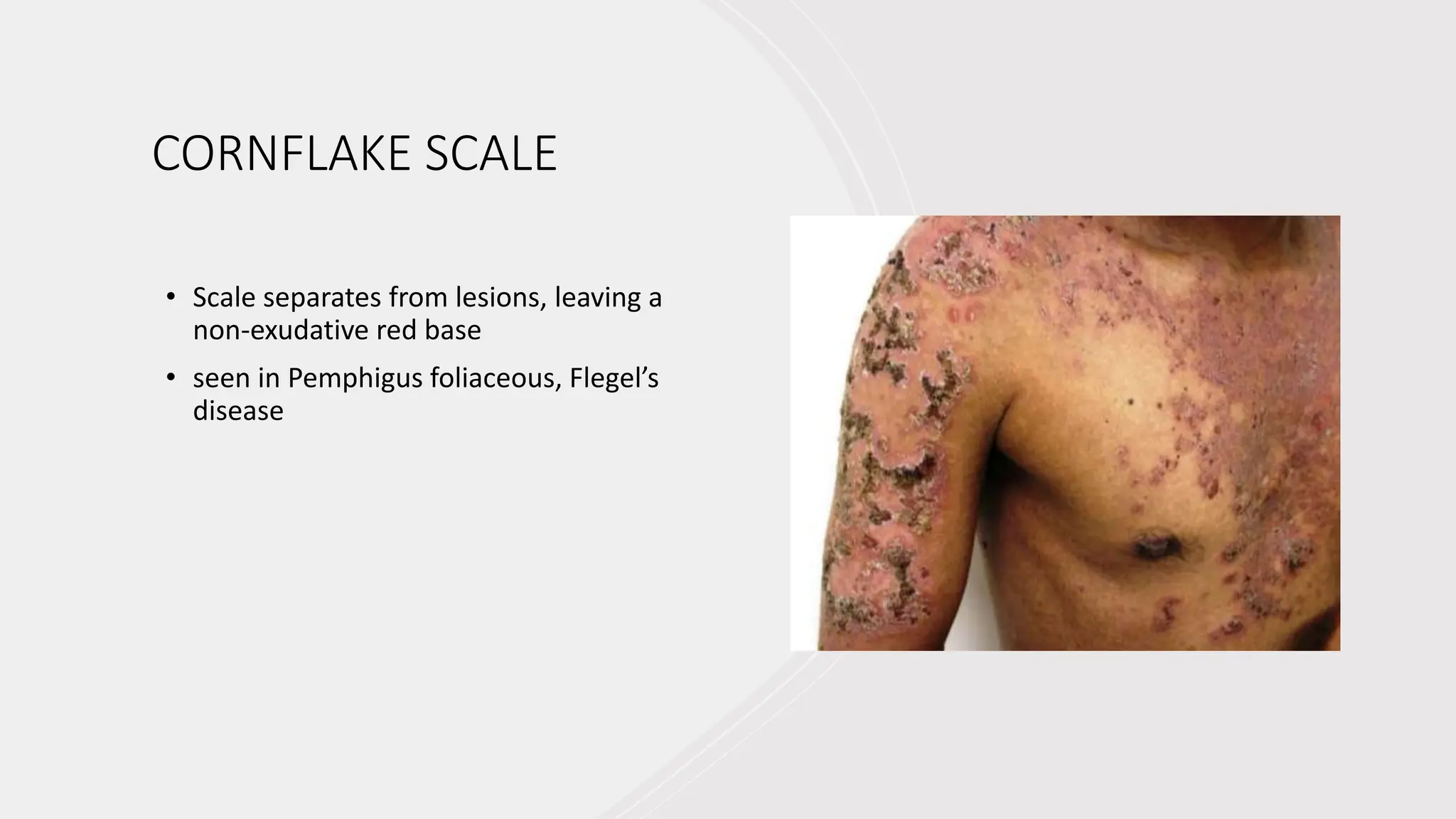 Clinical Classification of Skin Lesions: A Morphological Approach in ...