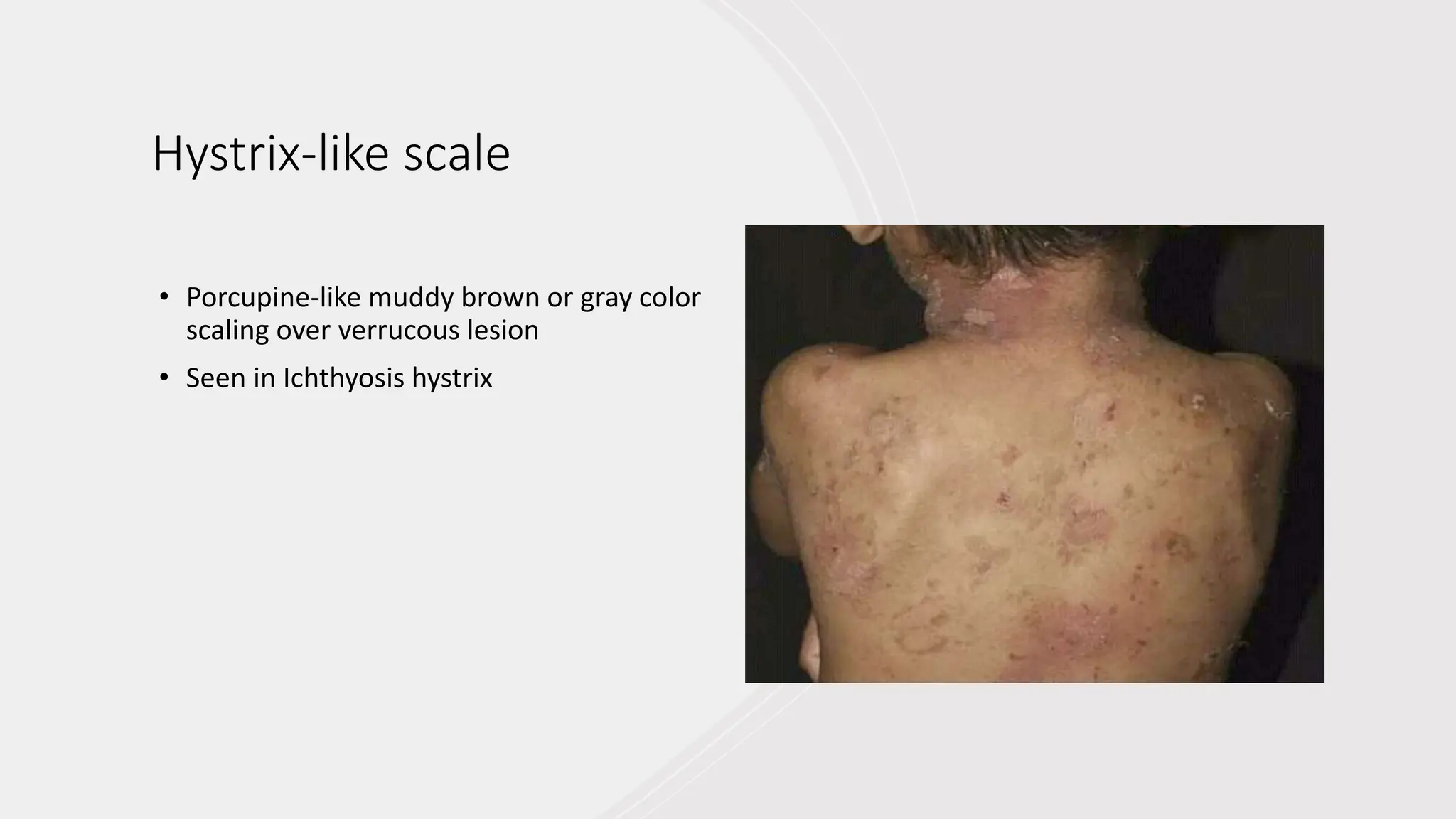 Clinical Classification of Skin Lesions: A Morphological Approach in ...