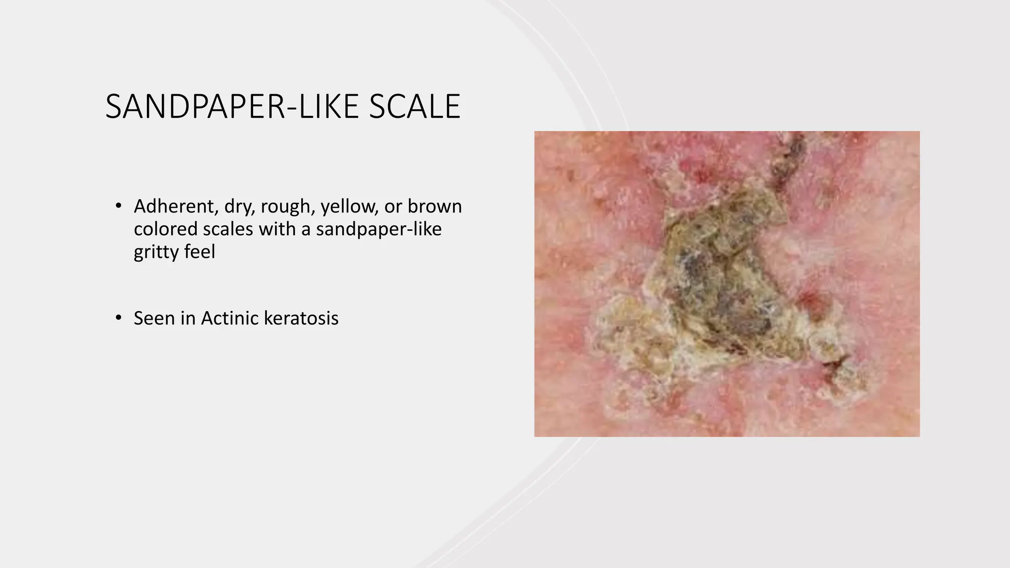 Clinical Classification of Skin Lesions: A Morphological Approach in ...