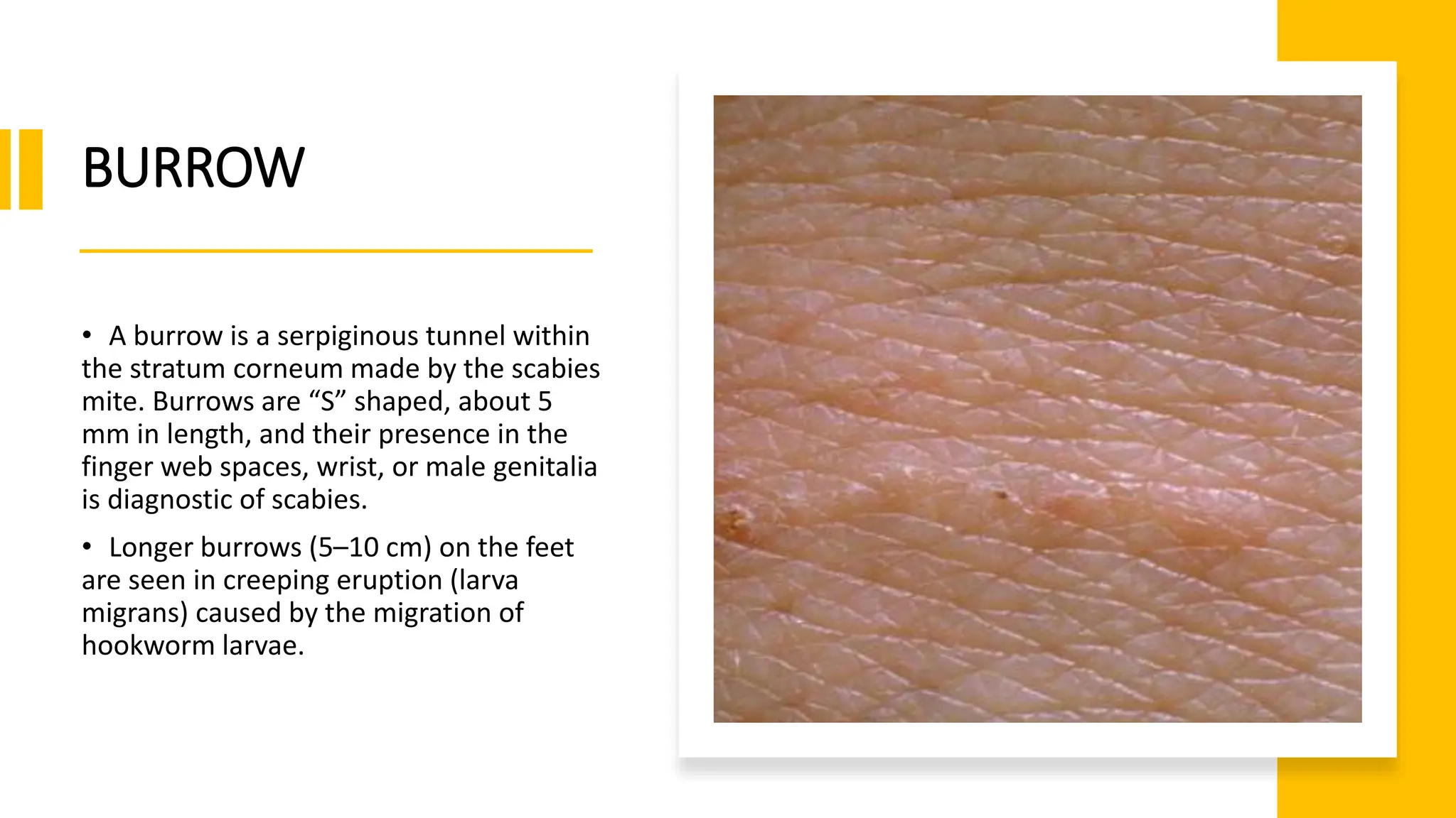 Clinical Classification of Skin Lesions: A Morphological Approach in ...