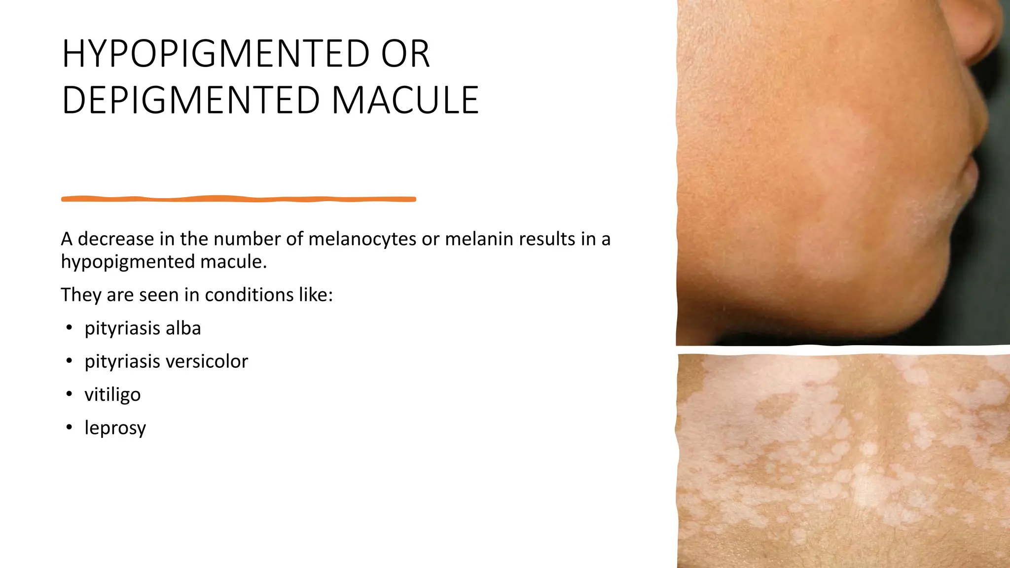 Clinical Classification of Skin Lesions: A Morphological Approach in ...