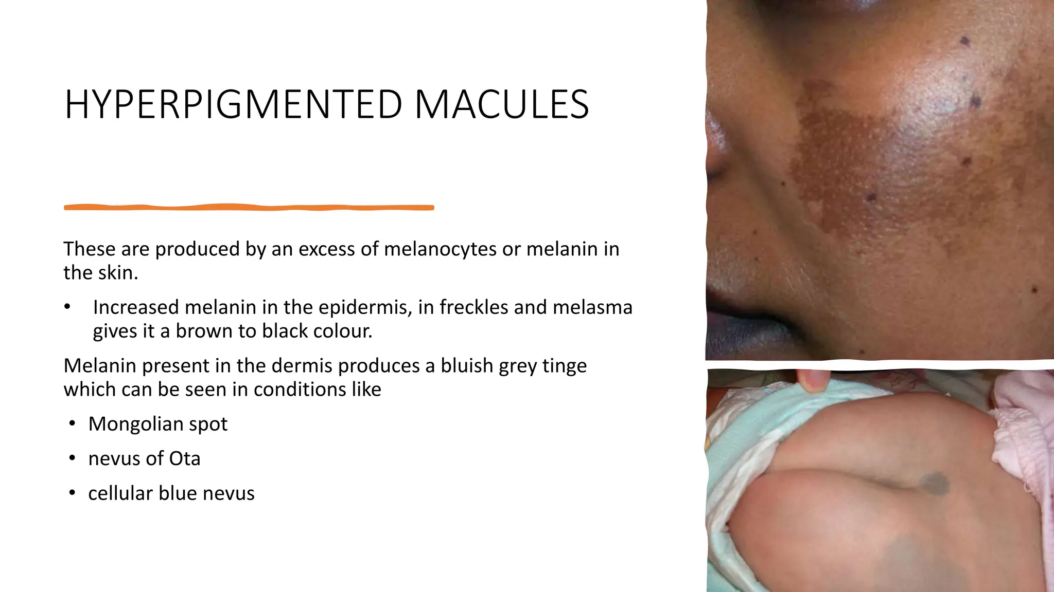 Clinical Classification of Skin Lesions: A Morphological Approach in ...