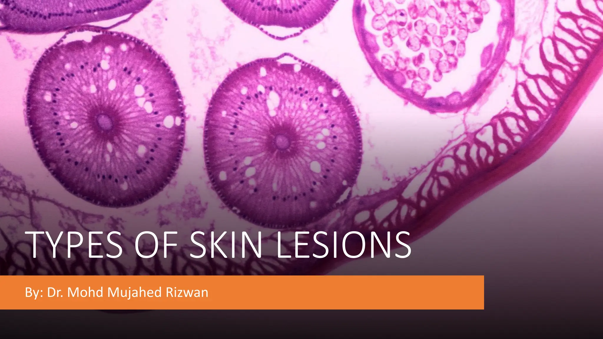 Types of skin lesions.pptx