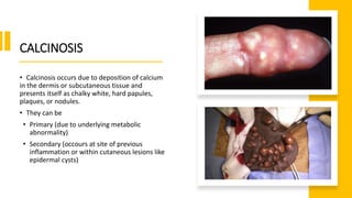Clinical Classification of Skin Lesions: A Morphological Approach in ...