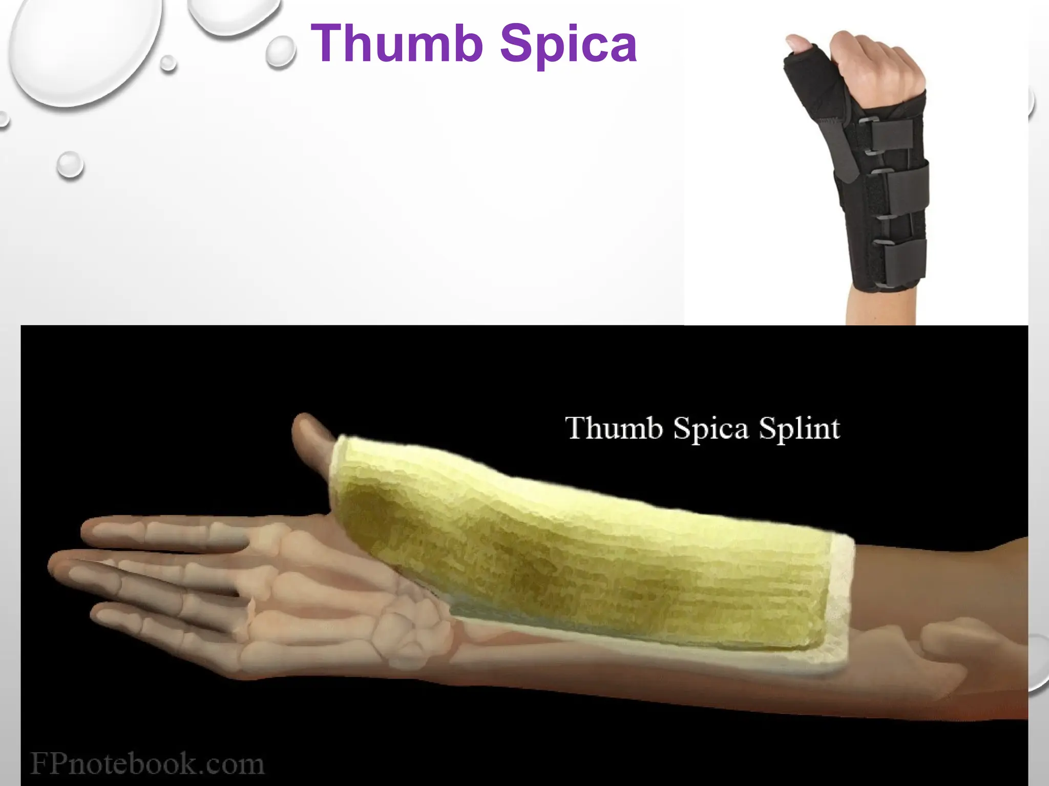 Types of Splints used during evacuation of victims .pptx