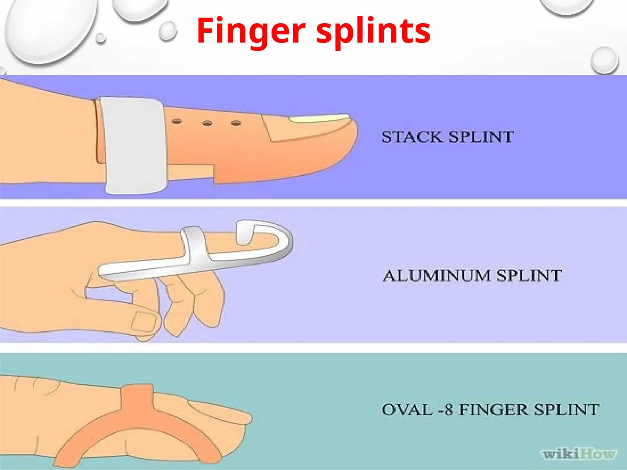 Types of Splints used during evacuation of victims .pptx