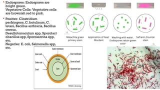 Types of staining- Principle and procedure | PPT