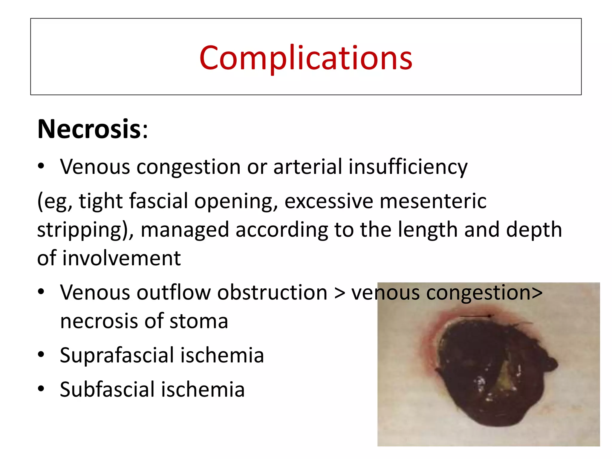 Types of intestinal stomas and management | PPTX