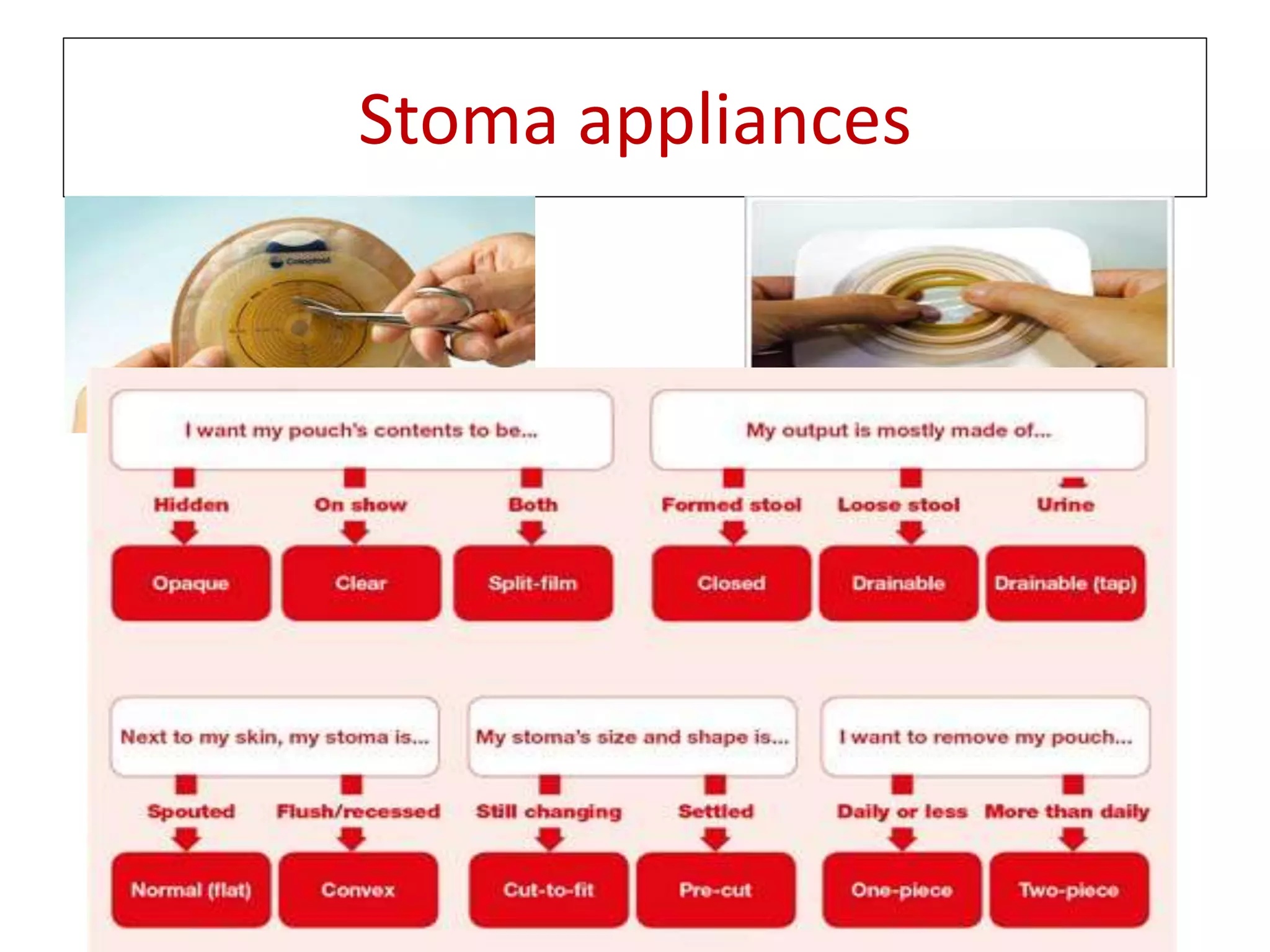 Types of intestinal stomas and management | PPTX