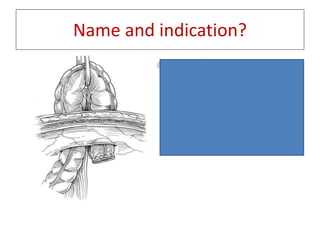 Types of intestinal stomas and management | PPTX